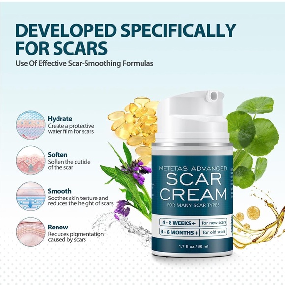 Other | Scar Cream | Poshmark
